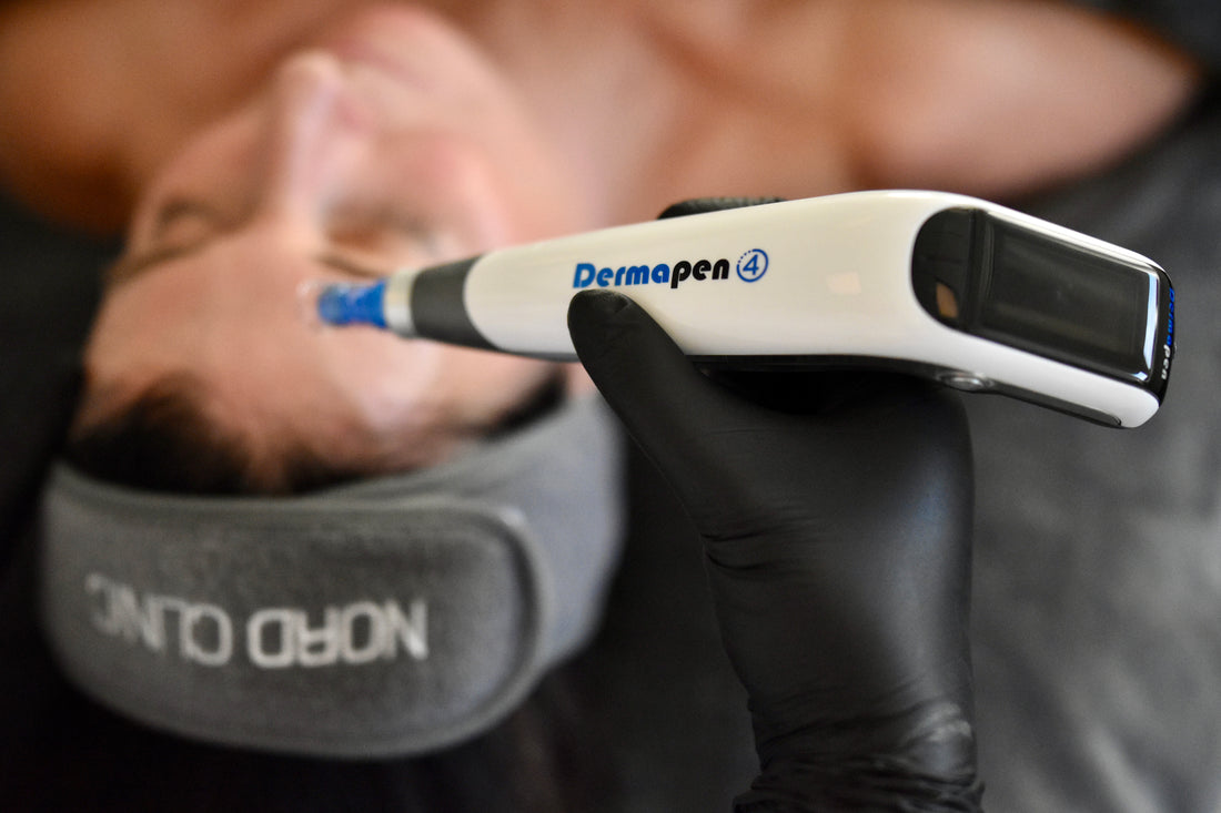 Dermapen 4 - Microneedling – Nord Clinic